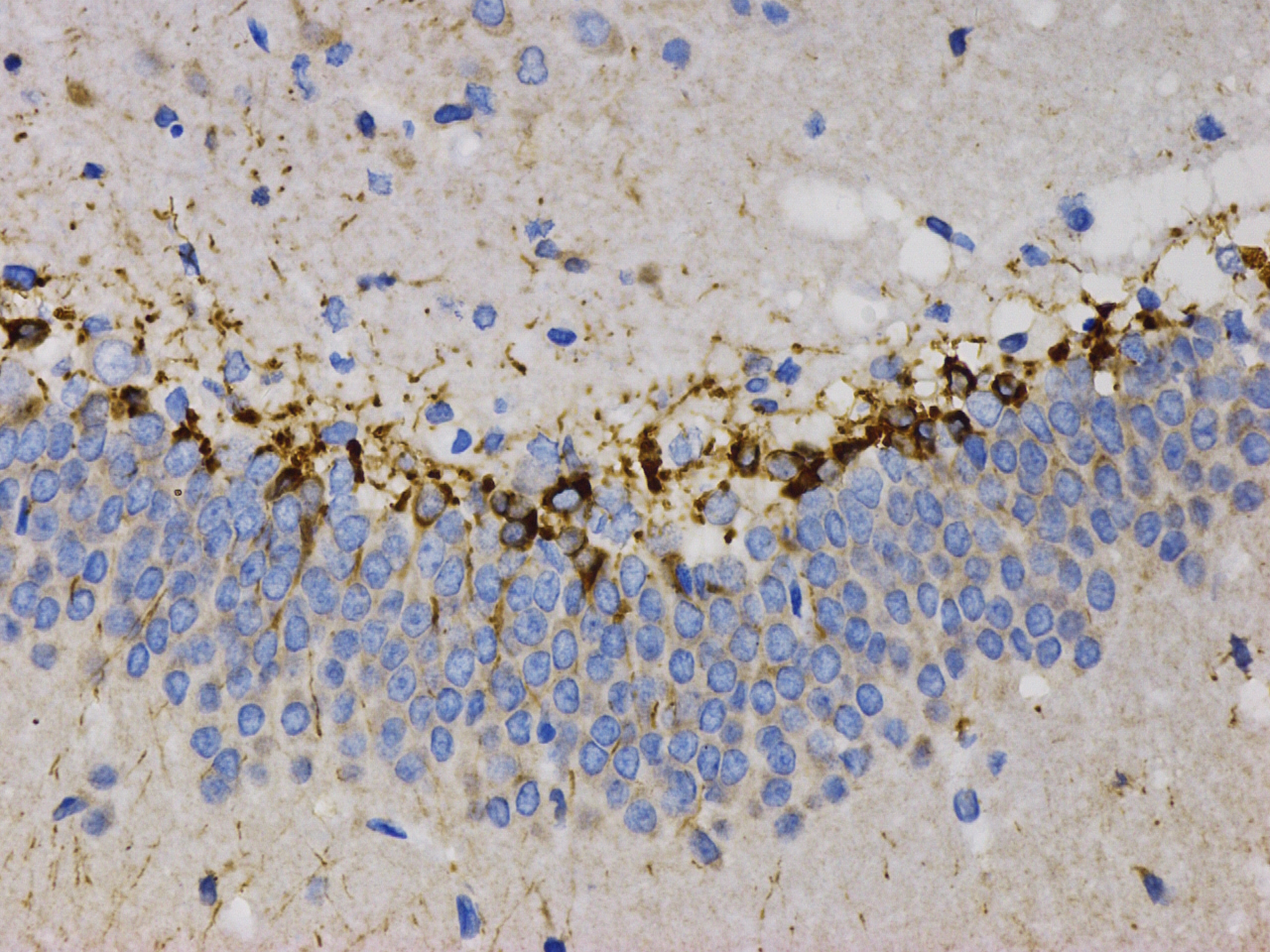 DCX - 上海茹创生物科技有限公司_多色免疫荧光试剂盒+多重免疫组化染色